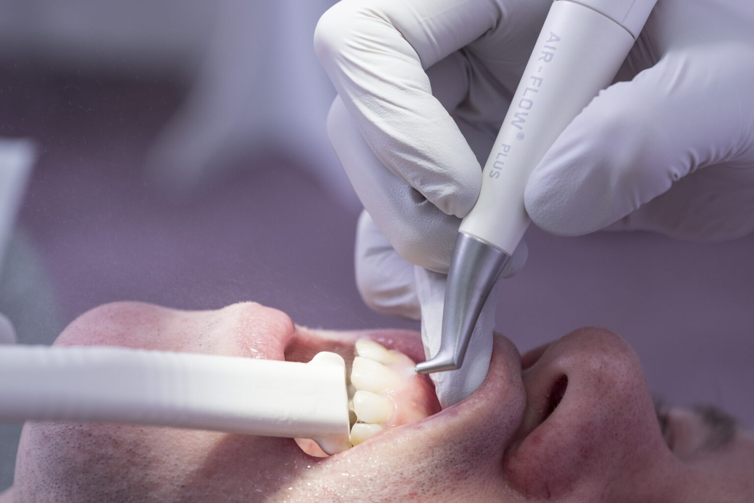 Airflow Prophylaxis master – Mondhygiene Leerdam